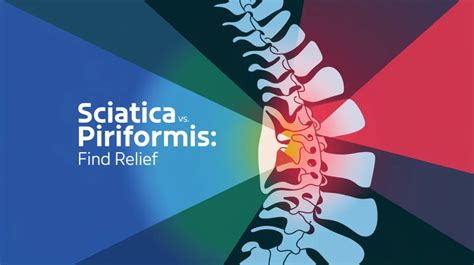 Sciatica Vs Piriformis Syndrome Spot The Difference And Get Relief Healix Therapy Physical