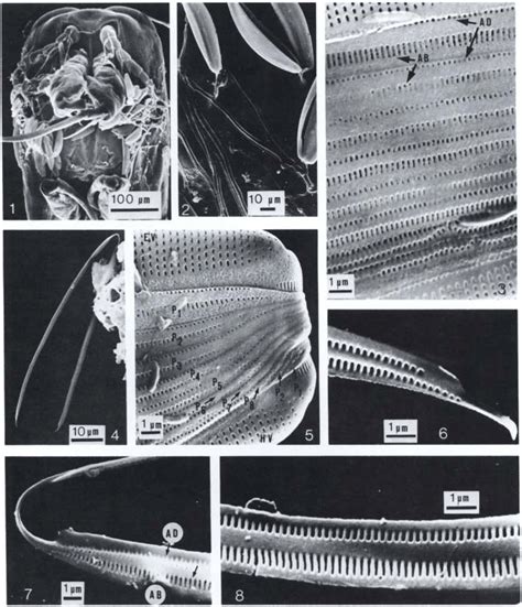 A Whole Band Fig 5 Epicingulum With Eight Bands Arranged In An