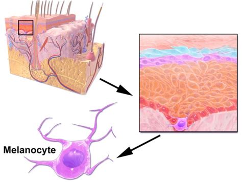 The Mystery Of Melanoma The Science Of Parkinsons