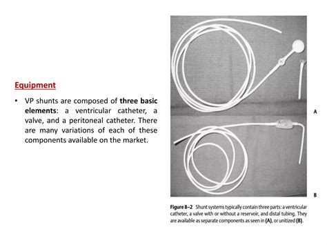 Shunt For Hydrocephalus Pptx