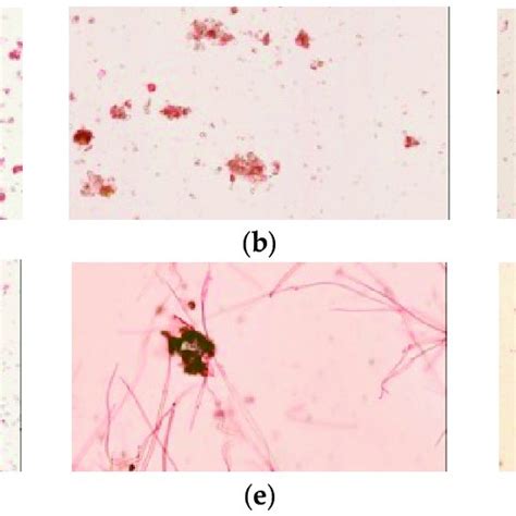 Microscopy Photographs With Iodine Solution Staining Light Microscopy