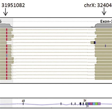 A Split Read Alignment In Split Read Alignment Input Sequence Reads