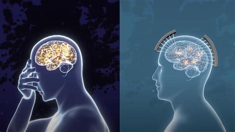 Next Generation Brain Machine Interface For Whole Brain Input Output University Of Plymouth