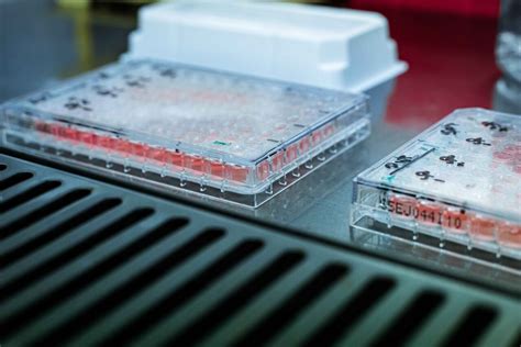 Elispot Assay Services And Analysis Kcas Bio