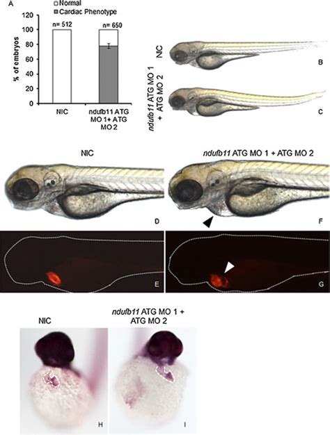 Microinjection Of Ndufb11morpholino Mo In Zebrafish Embryos Leads To