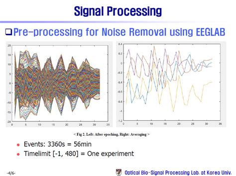 GitHub Soojin PreProcessing Bio Signal EEG Pre Processing Using MatLab