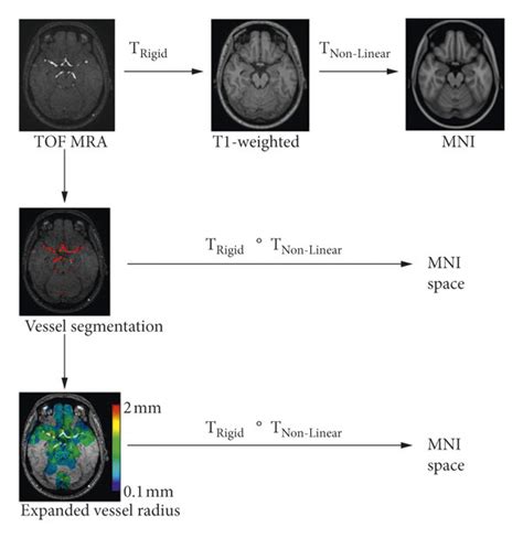 Cerebrovascular Edge Extraction Download Scientific Diagram