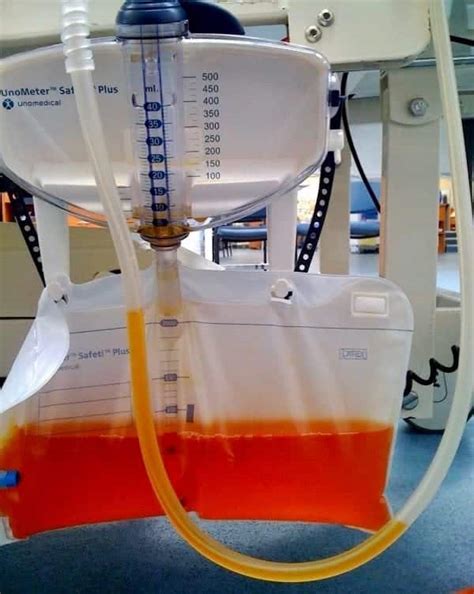 Where Are The Lemons • Litfl • Clinical Cases Unusual Urine