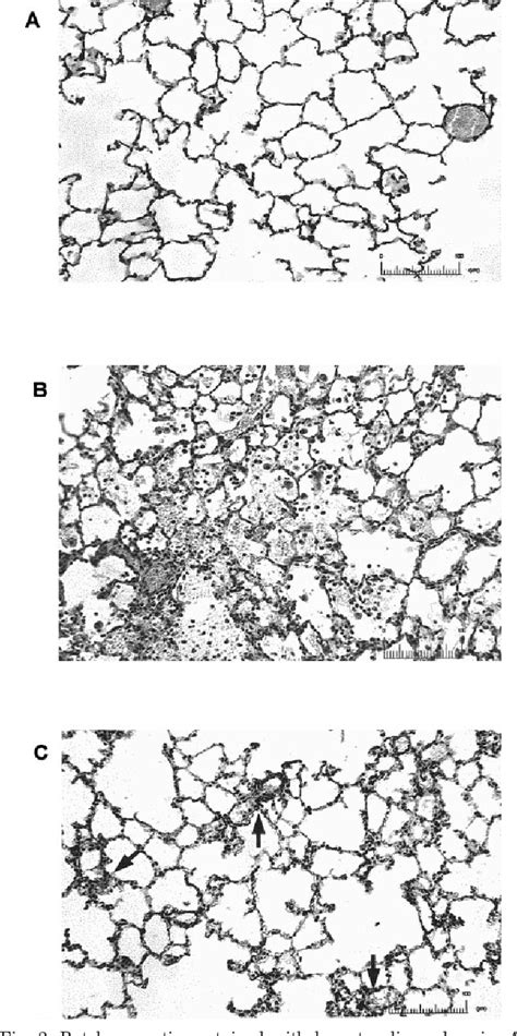 Figure 2 From Induction Of C Jun And Tgf Beta 1 In Fischer 344 Rats