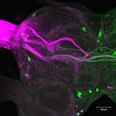 Invertebrate Brain Platform