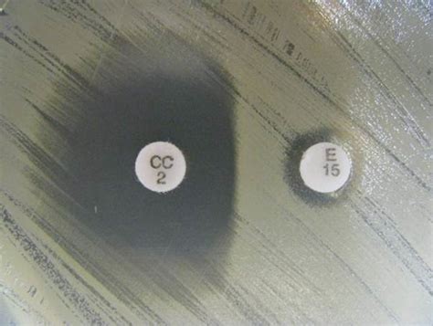 Inducible Clindamycin Resistance The D Test For Inducible Flickr