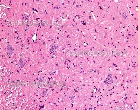 Nissl Bodies In Motor Neurons Light M Stock Image Science Source