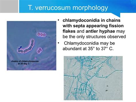 Trichophyton And Epidermophyton Ppt