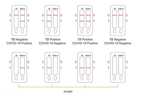Sars Cov 2 Tuberculosis Antigen Combo Rapid Test Kit Colloidal Gold Method Buy Sars Cov 2