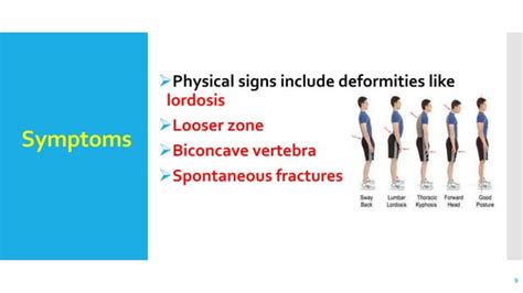 Osteomalacia Pptx Bone And Joint Conditions Diseases And Conditions