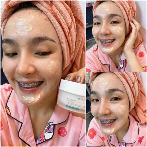 เรื่อง สิ ว ที่ไม่ สิ ว ๆ ที่ต้องจัดการ🚨 วัยรุ่นย่านไหนก็ใช้ชิเซน สาเหตุหลักของ สิ ว คือ