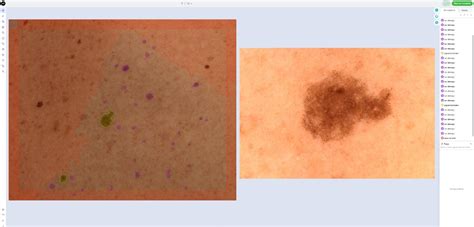 Anonymization And Annotation Data Flow In The University Of Queensland