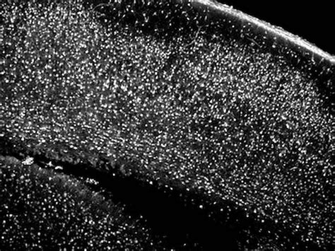 Researchers Controlled The Behavior In A Mouses Brain With Single Cell