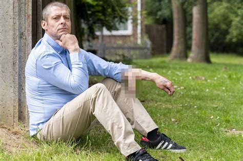 Lalaki Muling Nabigyan Ng Kinabukasan Matapos Lagyan Ng Ari Sa Braso