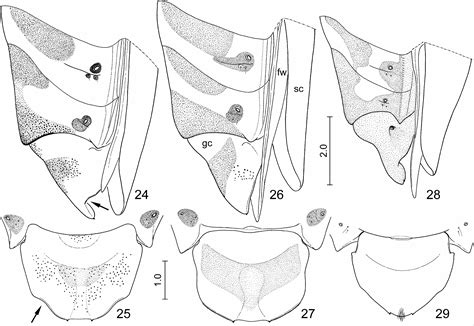 Figures 2429 In A Revision Of Scutellera Hemiptera Heteroptera