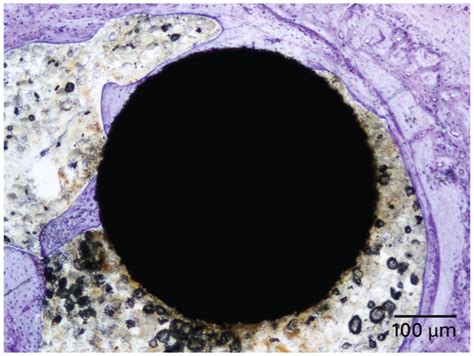 Osteoconductivity Of Thermal Sprayed Silver Containing Hydroxyapatite