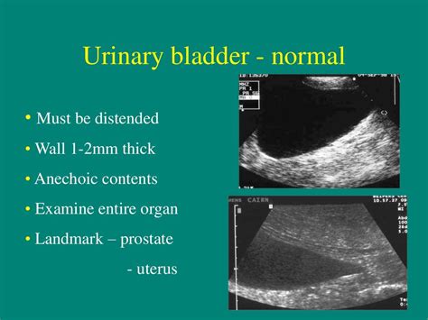 Urinary Bladder