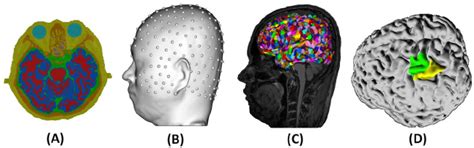 Individual Head Model For Eeg Source Estimation And Bold Registration Download Scientific