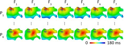 When We Take A Closer Look We Find That Fibers Do Affect Local Activation Patterns If