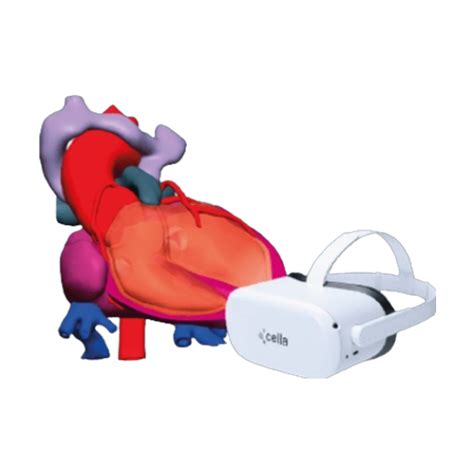 Medical Onex Cella Virtual Reality Environment Cella Medical Solutions S L