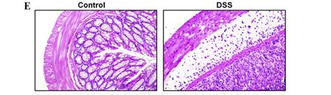 The Protocol Of Ulcerative Colitis Mice Modeling Using Dextran Sodium