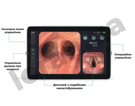 Flexible Video Endoscope Hugemed