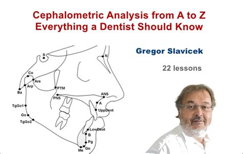 Cephalometric Analysis From A To Z Everything A Dentist Should Know