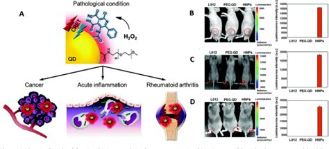 Figure 1 From Organic Persistent Luminescence Imaging For Biomedical Applications Semantic Scholar