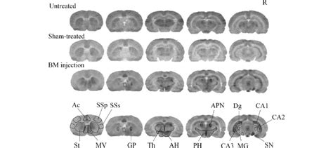 Autoradiograms Of 14 C Dg Uptake In The Rat Brain Representative Download Scientific Diagram