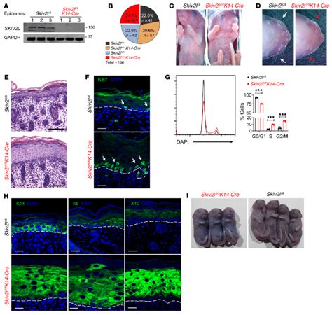 Epidermal Hyperproliferation In Germline Keratinocyte Specific Skiv2l Download Scientific