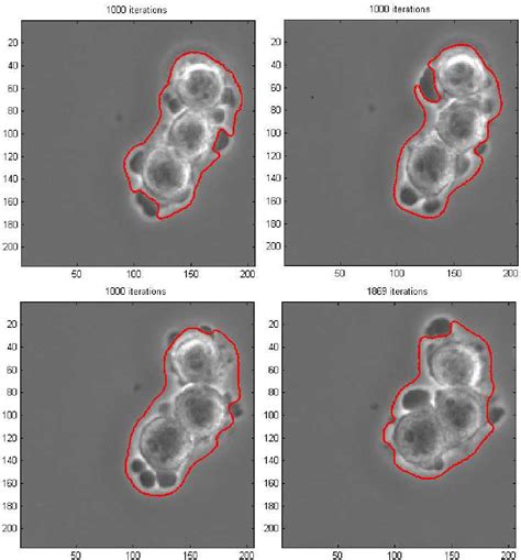 figure 1 from segmentation of microscopic images using level set