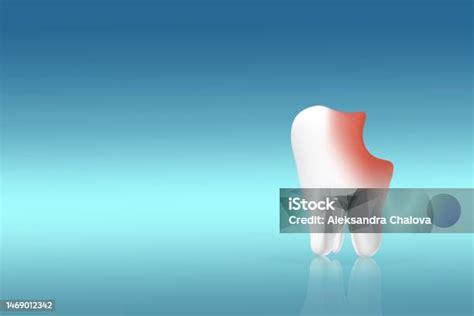 파스텔 블루 배경에 건강에 해로운 치아 흰색 어금니 모델 치아 기호 기호입니다 카리에스 충치와 치아의 질병 건강에 해로운 치아