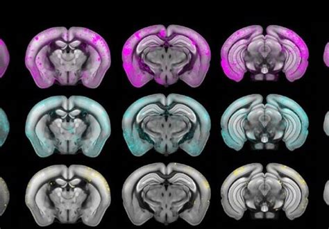 Parasite Could Revolutionize Brain Treatment Delivery Spacescience