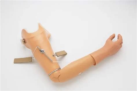 C P I Above Elbow Prosthesis At Best Price In Hyderabad Id 21277872812