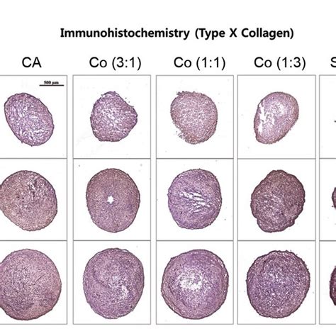Immunohistochemistry For Type X Collagen Hypertrophic Marker Staining