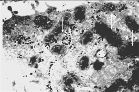 Ultrastructure Showing Numerous Mitochondria Arrows And Cytoplasmic