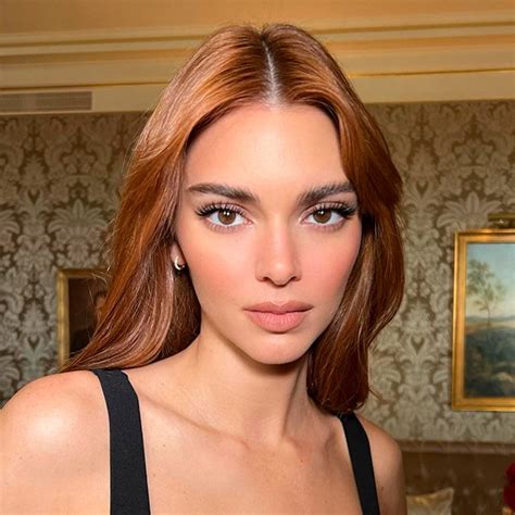 Tudo O Que Você Precisa Saber Sobre O Fotona 4d Steal The Look