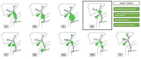 The Curious Case Of The Choledochal Cyst—revisiting The Todani