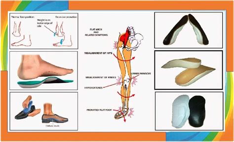 Black Leather Ucbl Orthosis Custom Shoe Inserts By Mycaremedical