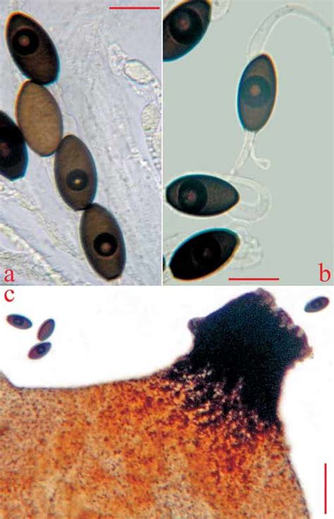 A C Podospora Anserina A Parts Of 4 Spored Asci With Spores In
