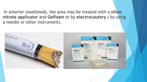 Treatment Of Epistaxis With Their Clinical Features Pptx