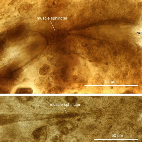 Light Micrograph Of Distal End Of Vagina Ventral View A Download Scientific Diagram