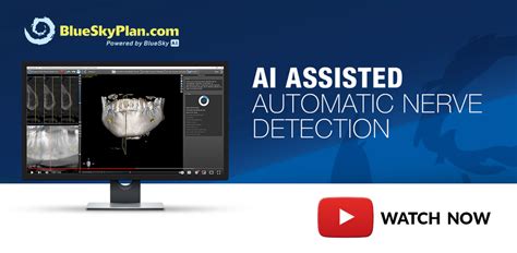 Fully Automatic Nerve Detection