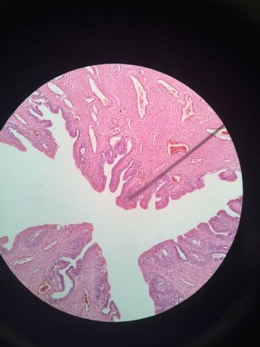 Urethraurinary Bladder Slide Flashcards Quizlet