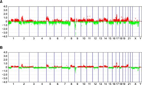 Whole Genome Array Cgh Profiles Of The Mda Mb 231 Using 2 Different